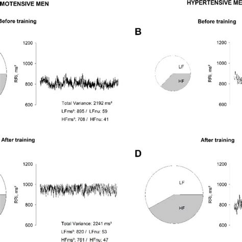 Representative Illustration Of Heart Rate Variability Parameters