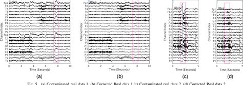 Figure 5 From Estimation Of Eog Artifacts From Eeg Signal By Orthogonal