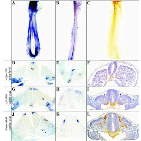 Noggin Inhibits Initial Delamination Of Neural Crest Cells From Neural