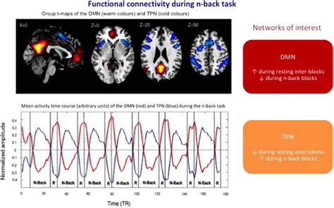 Anticorrelation Of Dmn And Tpn Networks During The N Back Task In