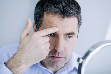 【メンズ向け肌タイプ診断】4つの肌タイプとおすすめのスキンケアを解説 男のエステ ダンディハウス