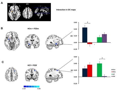 ijms free full text sex specific patterns of aberrant brain