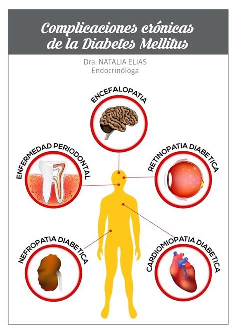 Tratamiento Para Evitar Complicaciones De La Diabetes
