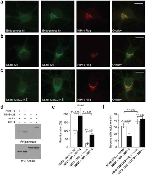 Hip14 Influences The Distribution And Catalyzes The Palmitoylation Of