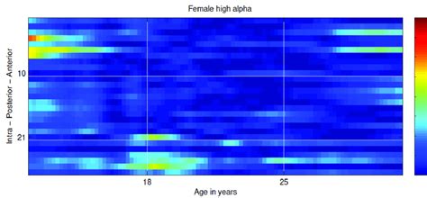 Association −log10 P Value Of Dsm Iv Ad Prs P