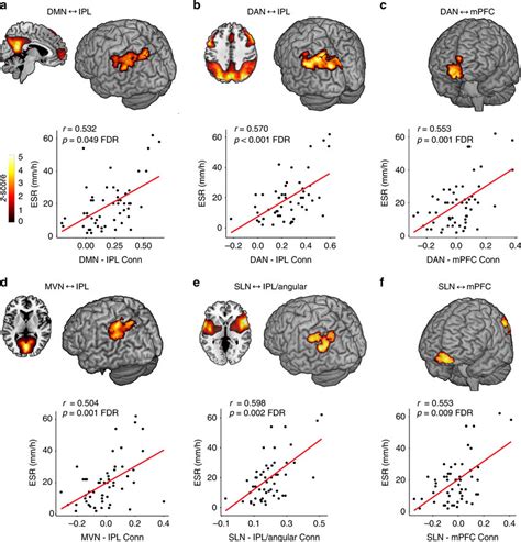 Inflammation Associated Functional Connectivity Patterns Brain Regions
