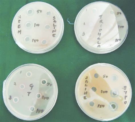 Agar Plates Showing Zones Of Inhibition Download Scientific Diagram