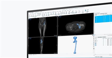 materialise mimics 3d medical image processing software