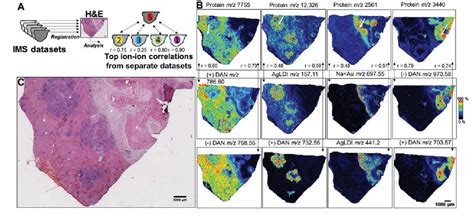 Figure 1 From Co Registration And Analysis Of Multiple Imaging Mass