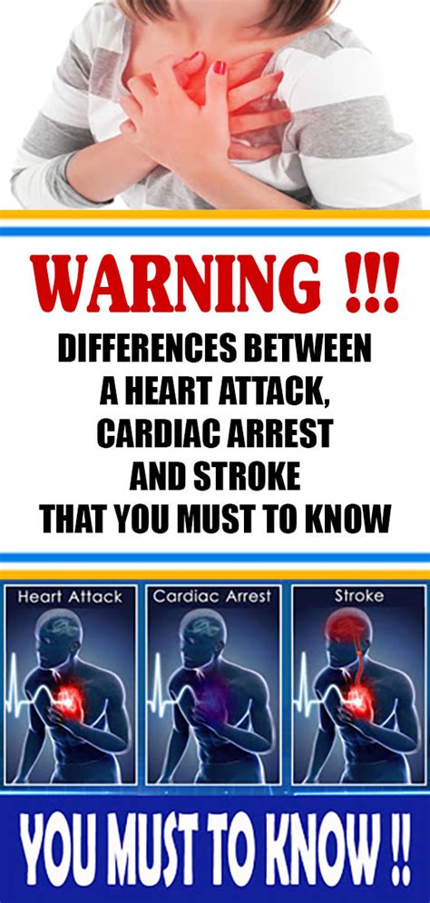 Differences Between A Heart Attack Cardiac Arrest And Stroke That You