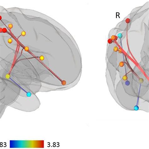 Between‐group Differences In Region‐to‐region Functional Connectivity
