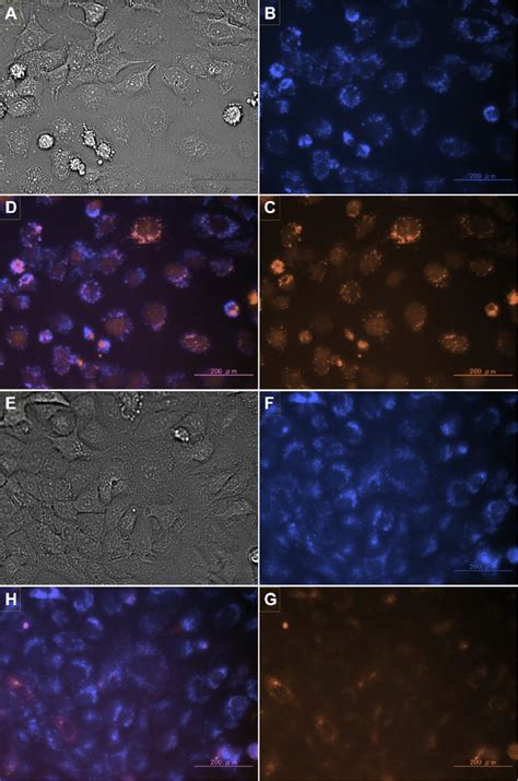 Subcellular Localization Of Internalized Dox Aed Dnd Pg Dox Eeh