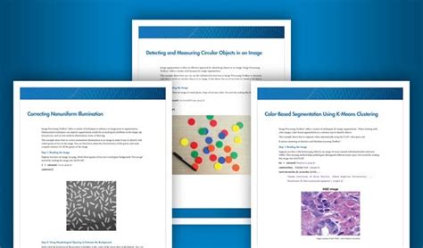 matlab medical image processing toolbox imaegus
