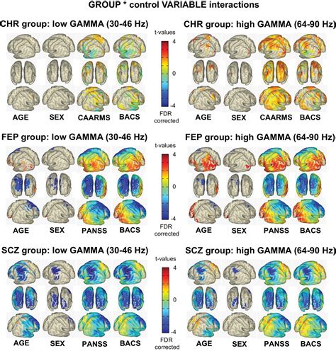 Resting State Gamma Band Power Alterations In Schizophrenia Reveal E I