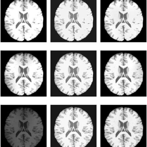 Segmentation Results And Bias‐correction Results For Brain Mr Images