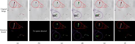 Figure 4 From Automated Non Invasive Analysis Of Motile Sperms Using