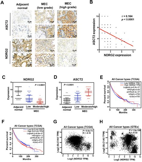 The Interplay Between Ndrg2 And Asct2 Dictates Tumor Malignancy A