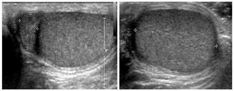 Scrotal Imaging Concise Medical Knowledge