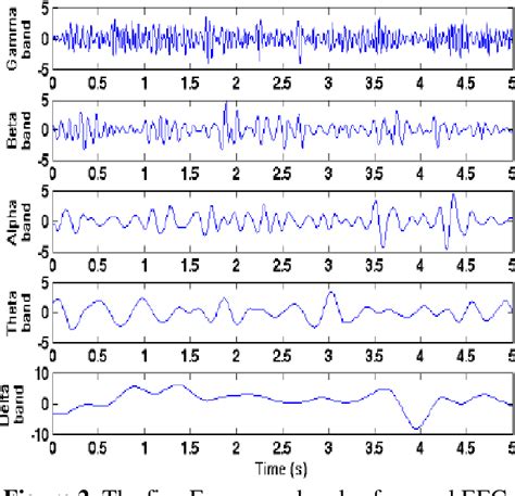 Figure 1 From Classification Of Epileptic And Non Epileptic Eeg Signal