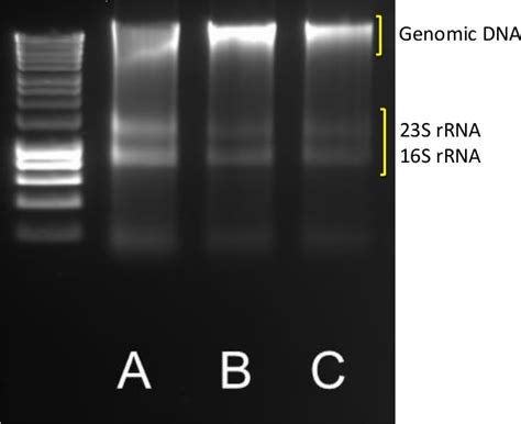 Simultaneous Dna Rna Extraction From Coastal Sediments And