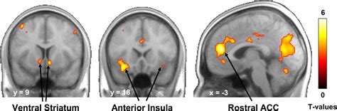 The Architecture Of Reward Value Coding In The Human Orbitofrontal