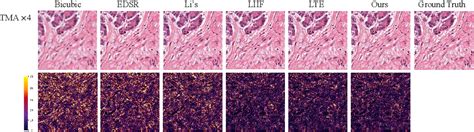 Figure 3 From Towards Arbitrary Scale Histopathology Image Super