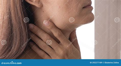 Cervical Lymphadenitis Of The Right Side In A Woman Stock Image