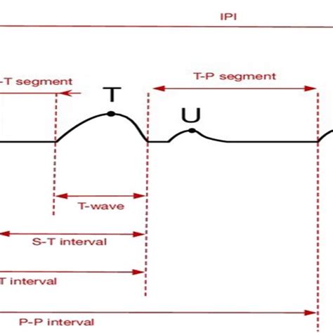 Block Diagram Of An Ecg Signal [3] Download Scientific Diagram