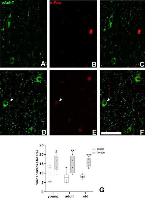 Cellular Activation Of Cholinergic Neurons In The Ts65dn Mouse Model