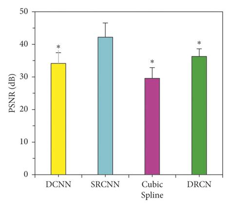 Comparison Of Psnr Of Reconstructed Mri Images With Different