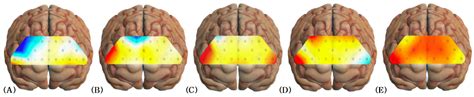 Medicina Free Full Text Comparison Of The Influence Of Dual Task