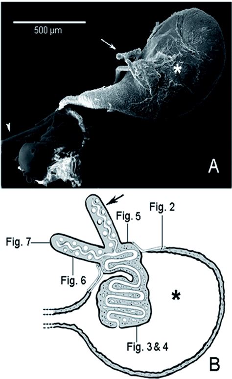 General Organization Of The Venom Apparatus Of Solenopsis Saevissima