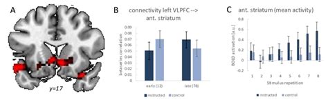 Summary Of The Functional Connectivity Analysis Results For The Left