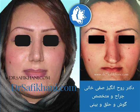 گالری دکتر روح انگیز صفی خانی جراح و متخصص گوش و حلق و بینی جراح