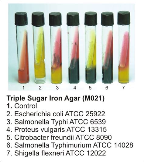 Tsia Test Principle Media Procedure Results Uses