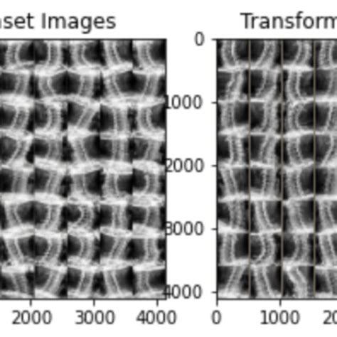 Comparison Of The Result Values Of The Resnet50 Model That Applied All