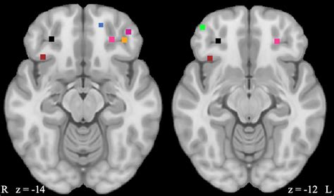 Orbitofrontal Cortex Ofc Clusters Demonstrating Connectivity With