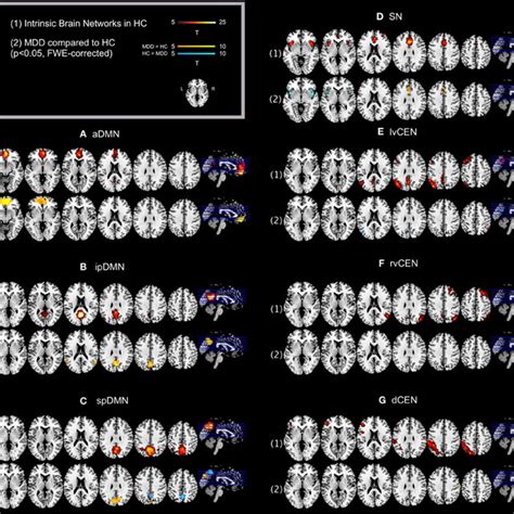 Default Mode Network Salience Network And Central Executive Network