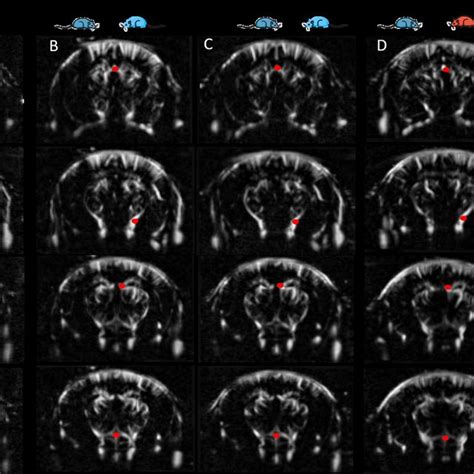 Pdf Fully Automatic Ultrasound Based Neuro Navigation The