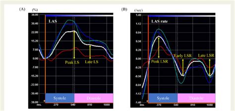 Typical Measurement Examples Of The Left Atrium Strain A And Left