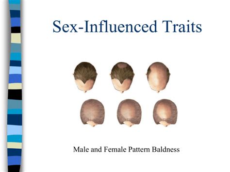 Sex Influenced Traits