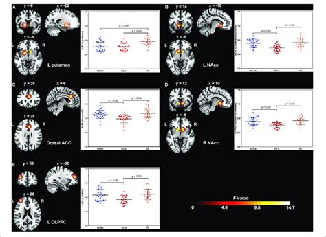 Significantly Different Clusters And Their Alff Values Among The