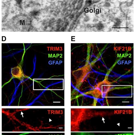 A Kif21b Locates To The Somato Dendritic Compartment Of Neurons And