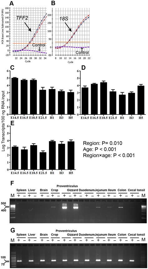 Spatio Temporal Expression Of Tff2 Transcripts In Download