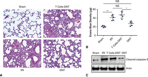 Cd3 Cd4 Cd8 Double Negative αβ T Cells Attenuate Lung Ischemia