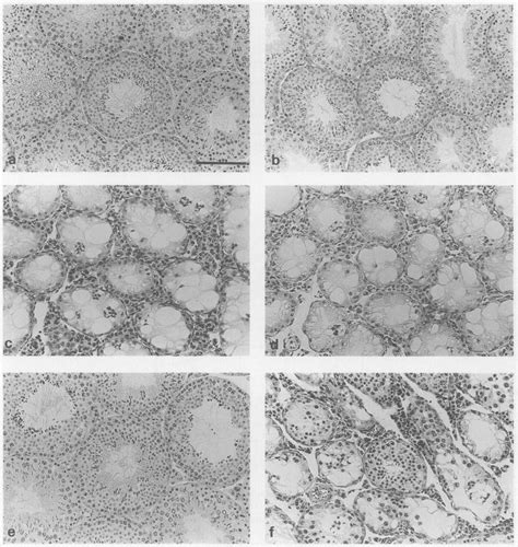 Light Micrographs Of Testicular Cross Sections Showing Intact Testes