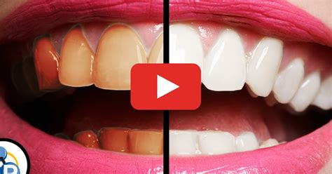 The Fact Regarding Teeth Lightening Threats And Negative Effects