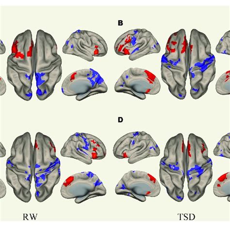 Whole Brain Functional Connectivity Patterns Of The Putamen Before 36
