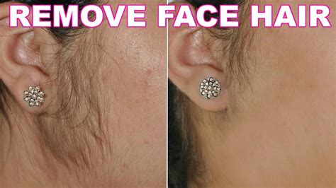 How To Remove Facial Hair Naturally Skincare Home Remedy