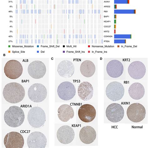 Mutational Landscape Of Smgs In Hcc A Significantly Mutated Genes
